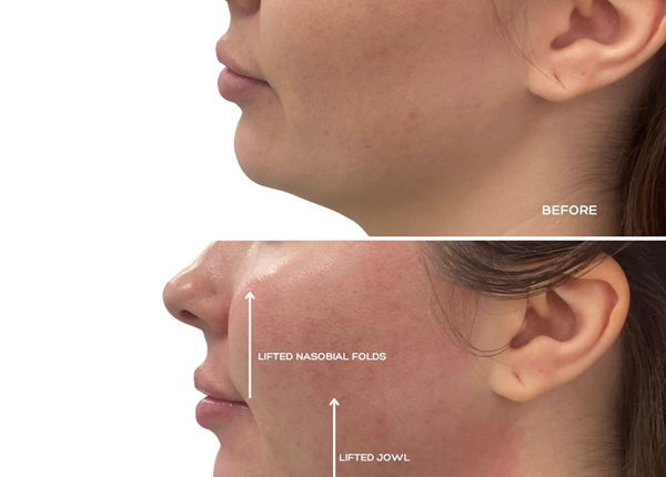 SylfirmX - The Flawless Lab